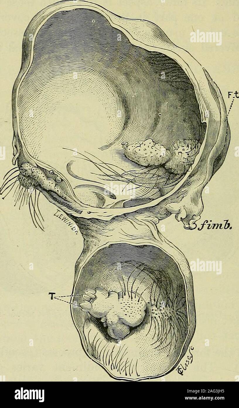 . Tumours, innocent and malignant; their clinical characters and ...