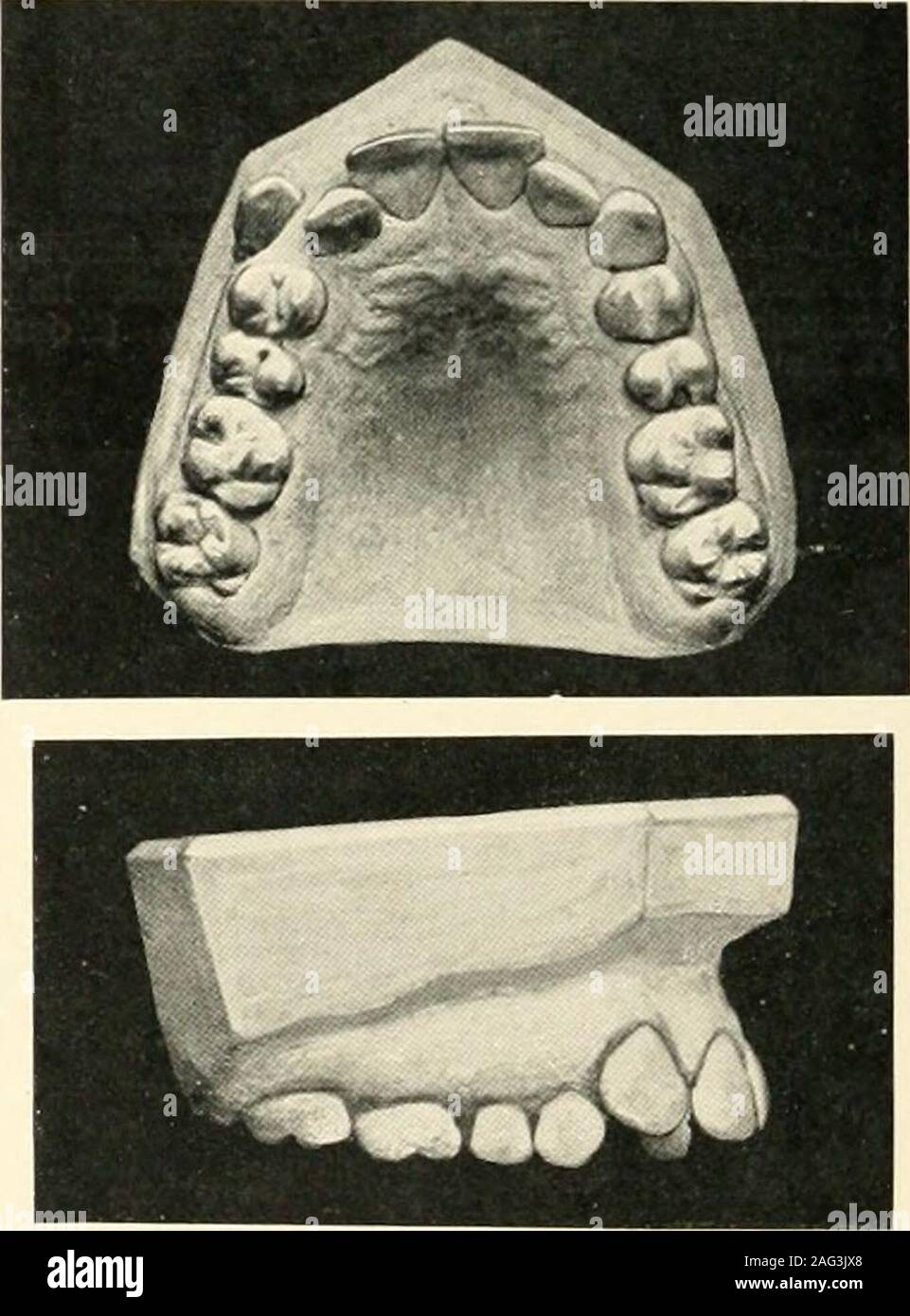 Malalignment hi-res stock photography and images - Alamy