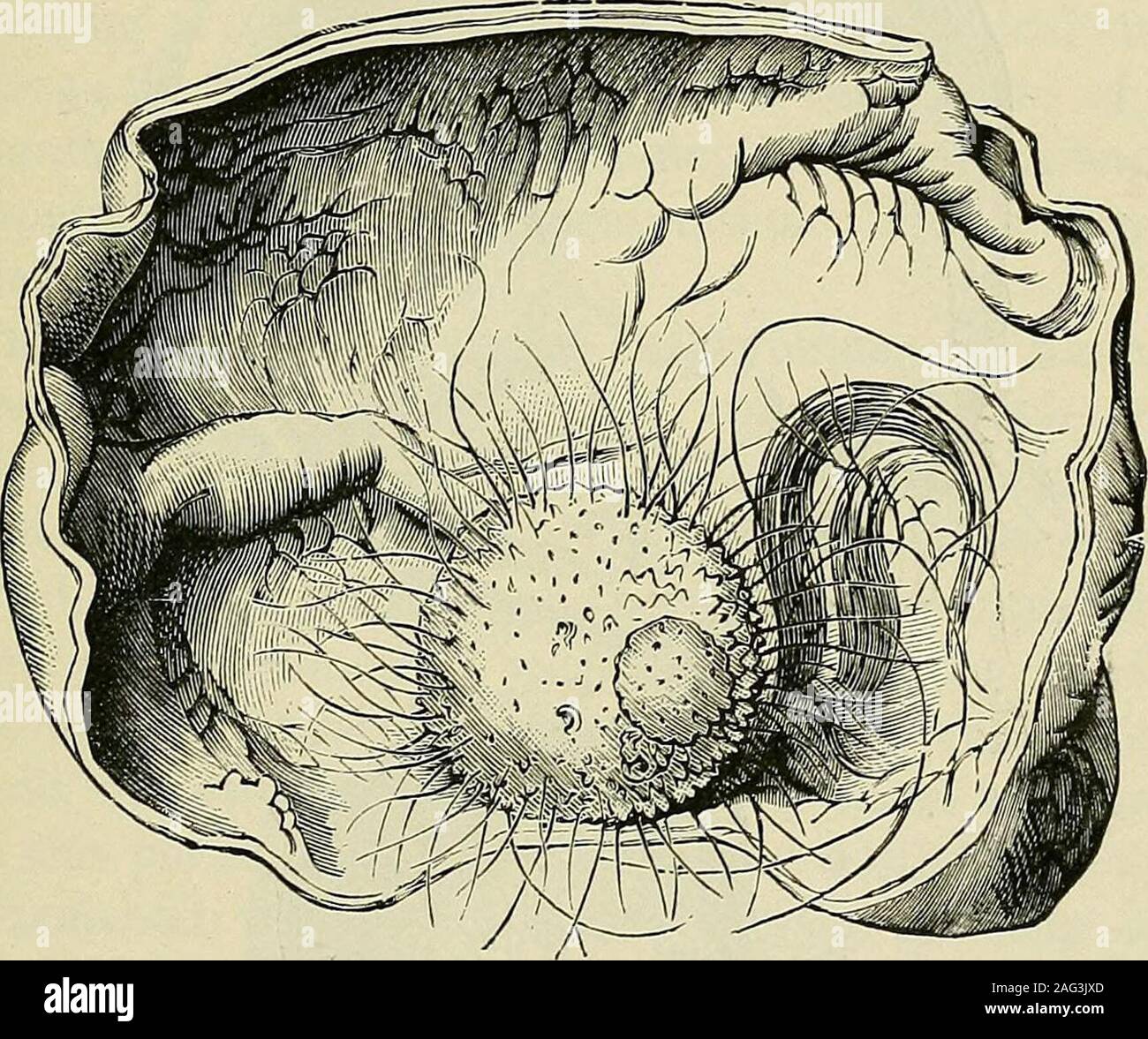 . Tumours, innocent and malignant; their clinical characters and ...