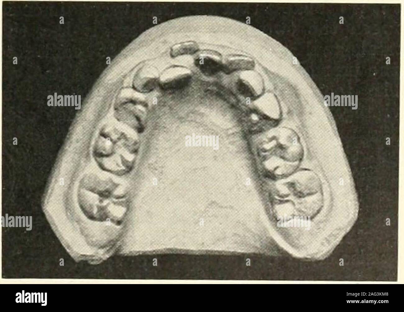 Imbrication hi-res stock photography and images - Alamy