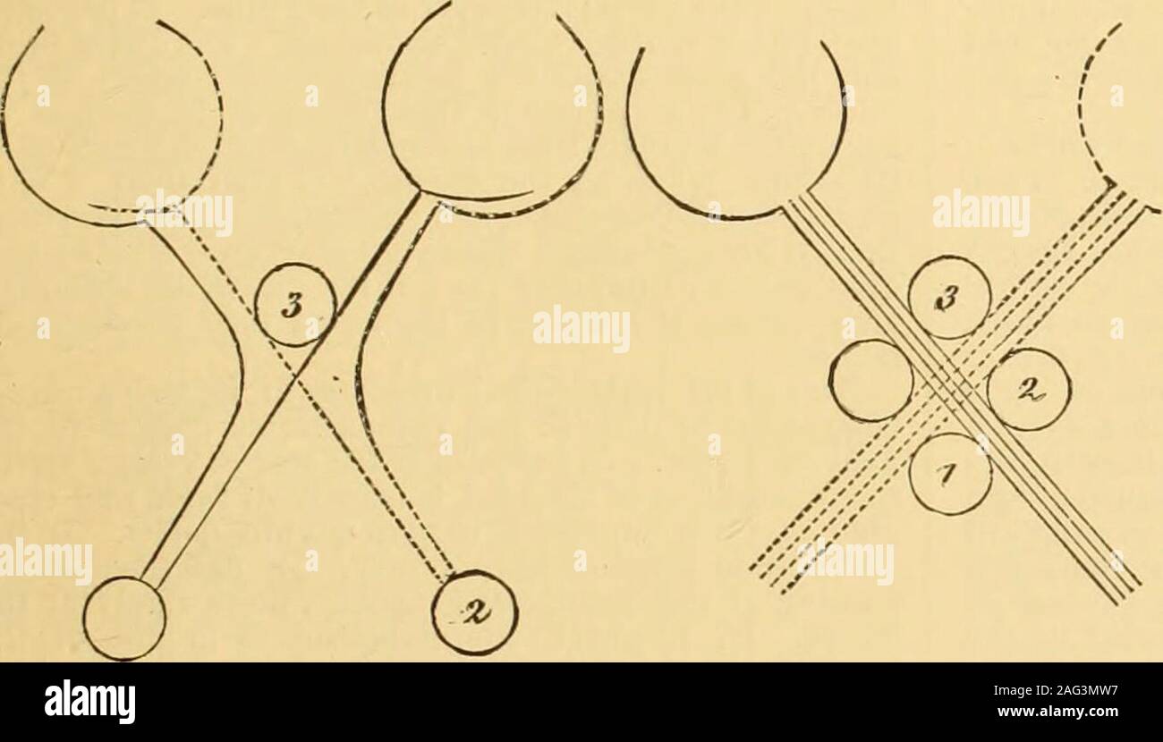 Visual field narrowing hi-res stock photography and images - Alamy