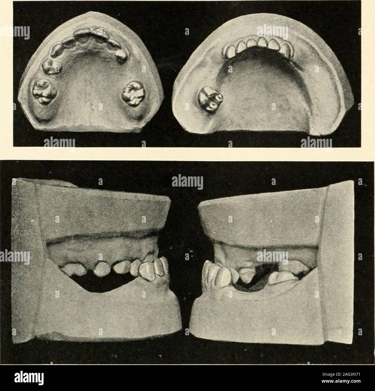 Proper positions hi-res stock photography and images - Alamy