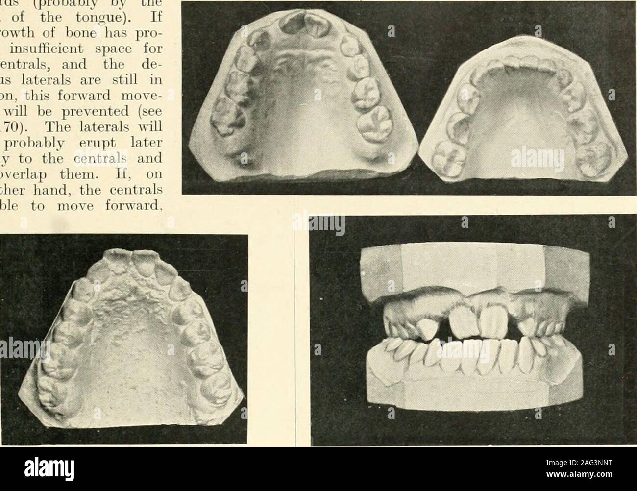 Central lower incisors hi-res stock photography and images - Alamy