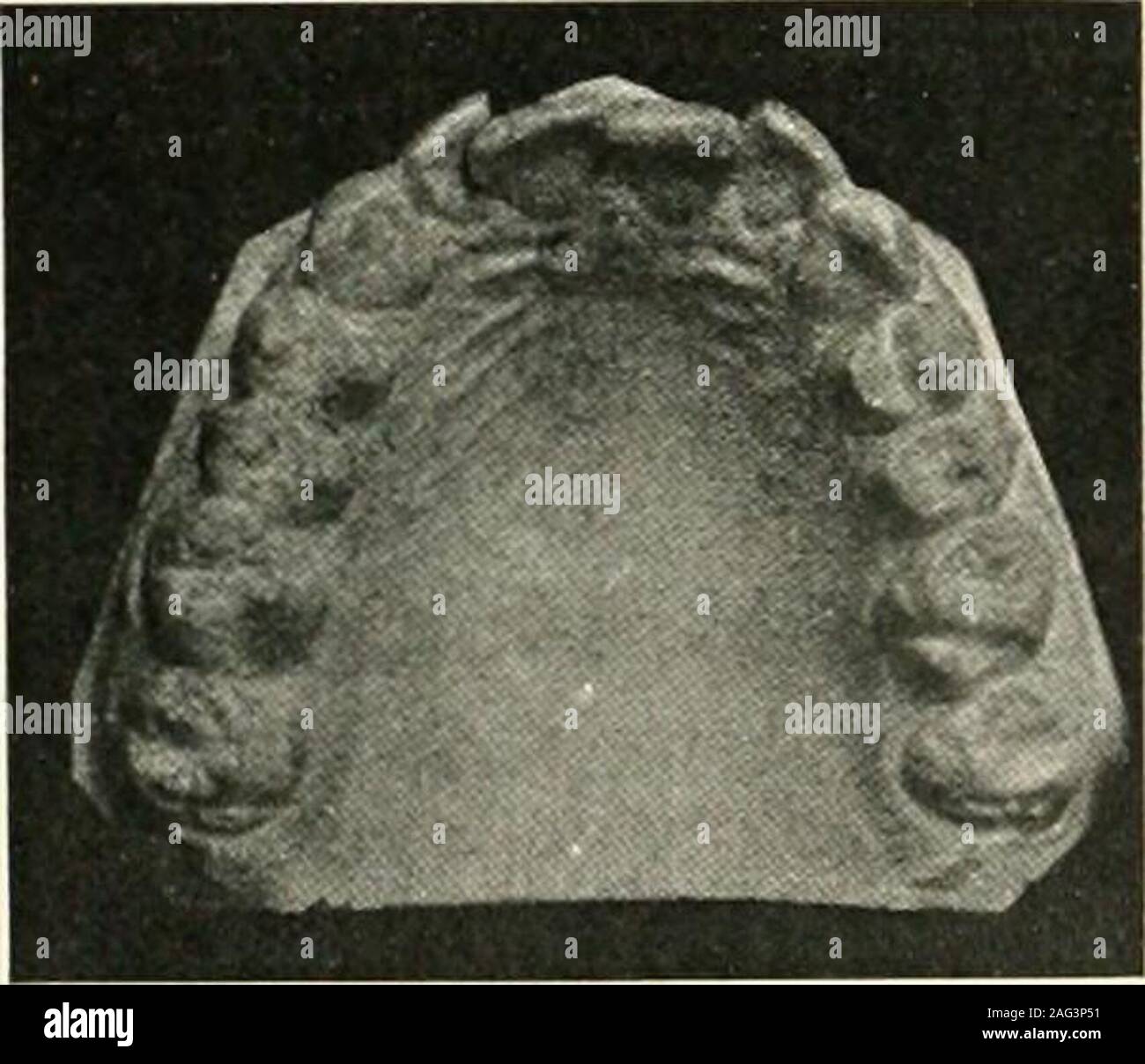 Lateral rotation hi-res stock photography and images - Alamy