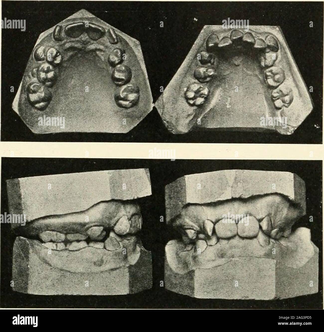 Lateral rotation hi-res stock photography and images - Alamy