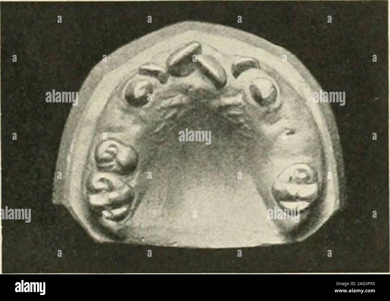 Second premolar hi-res stock photography and images - Alamy