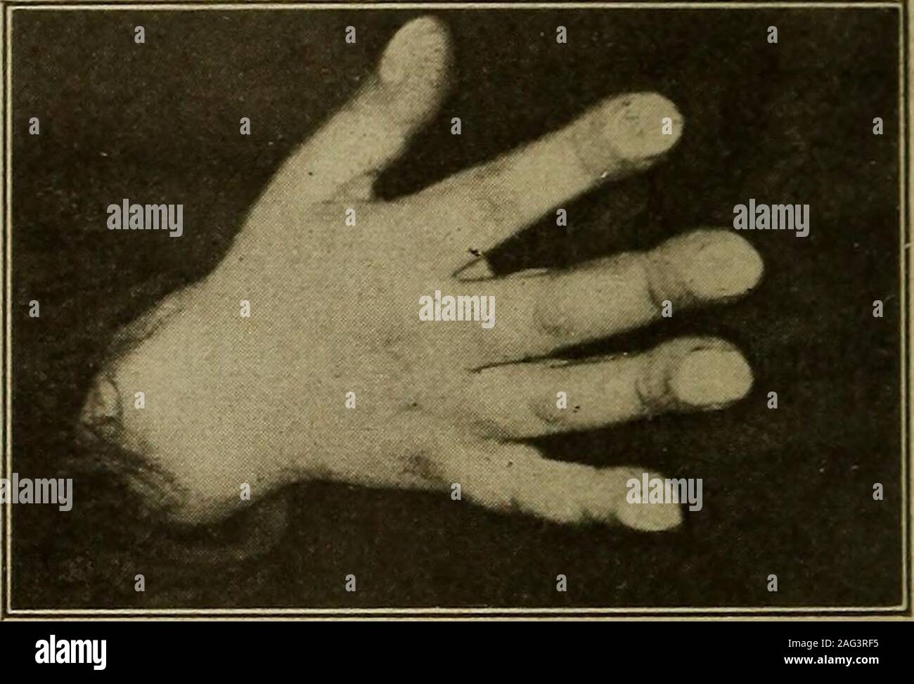 Cardiagnosis hi-res stock photography and images - Alamy