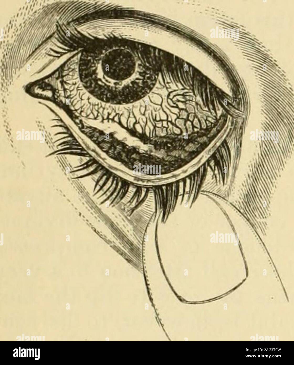 Pen lid hole hi-res stock photography and images - Alamy