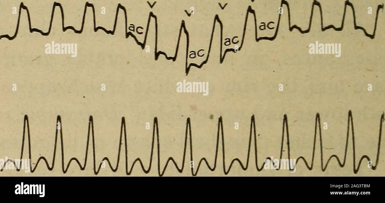 Erector pili hi-res stock photography and images - Alamy