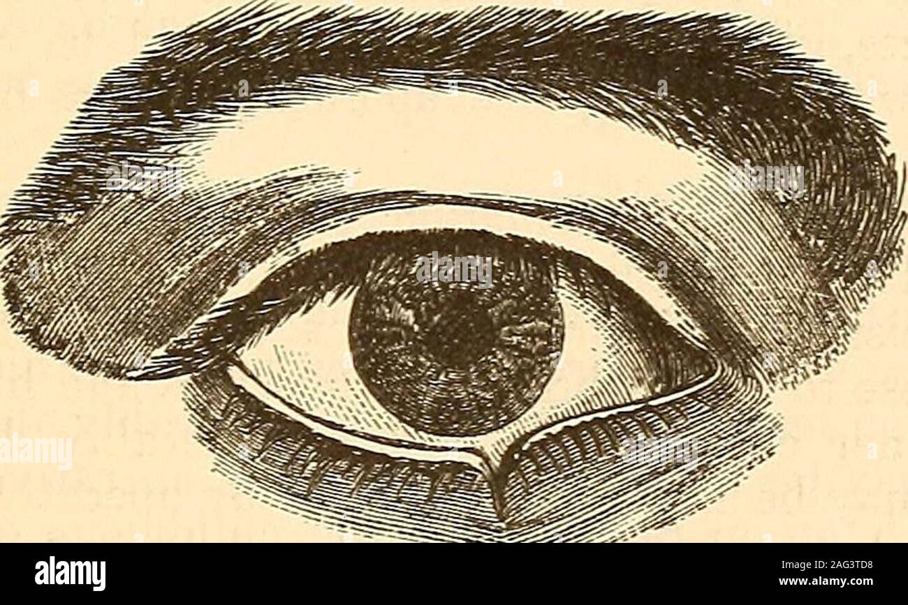 . A treatise on the diseases of the eye. usion ofthe parts, there is ...