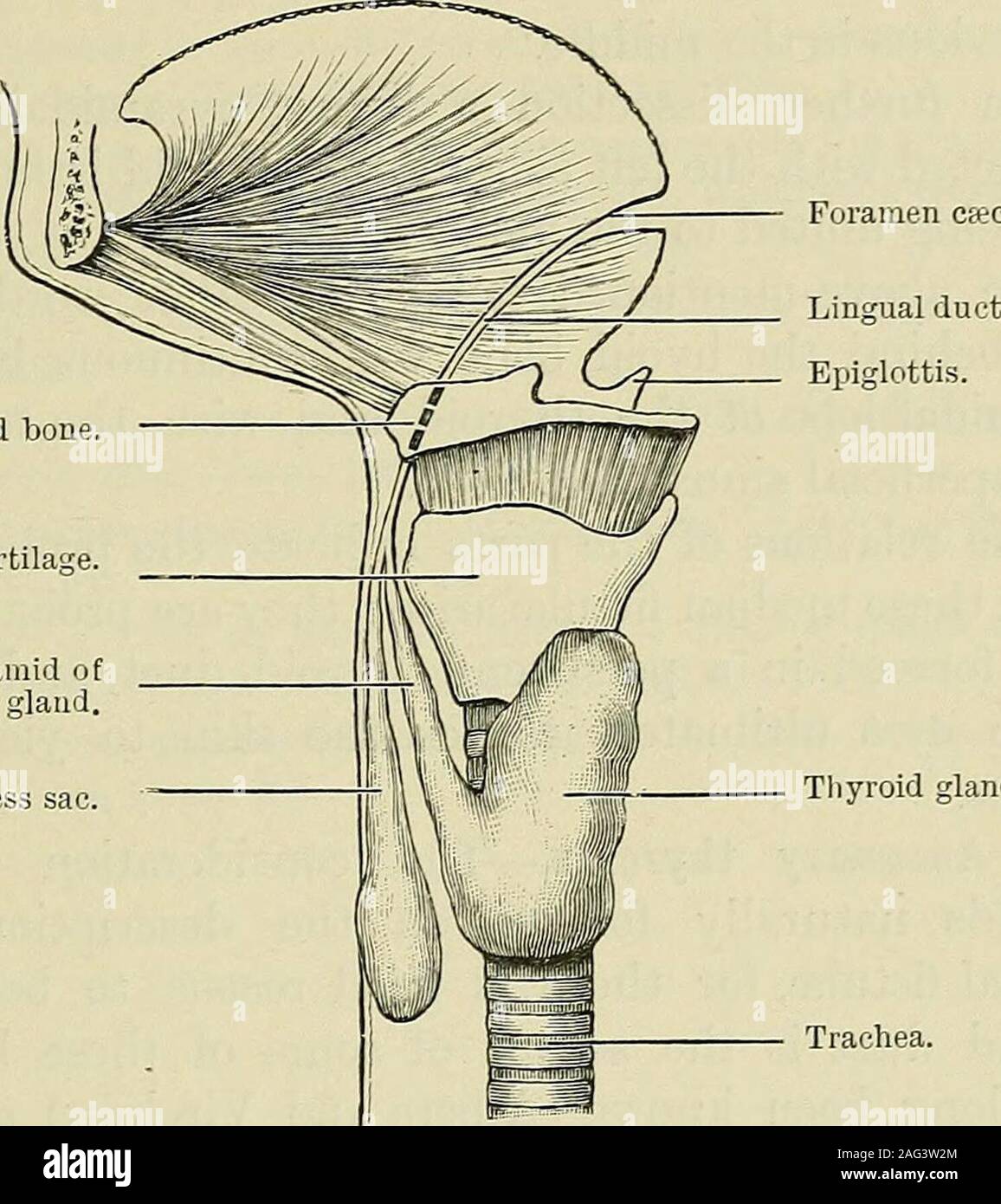 Persistent Cervical Sinus