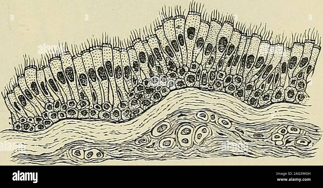 . Tumours, innocent and malignant; their clinical characters and ...