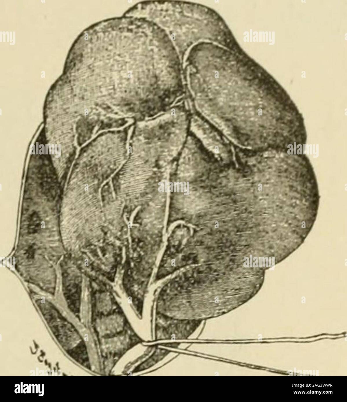 . Manual of operative surgery. Fig. 390.—{Kocher.) Fig. 391.—{Kocher ...