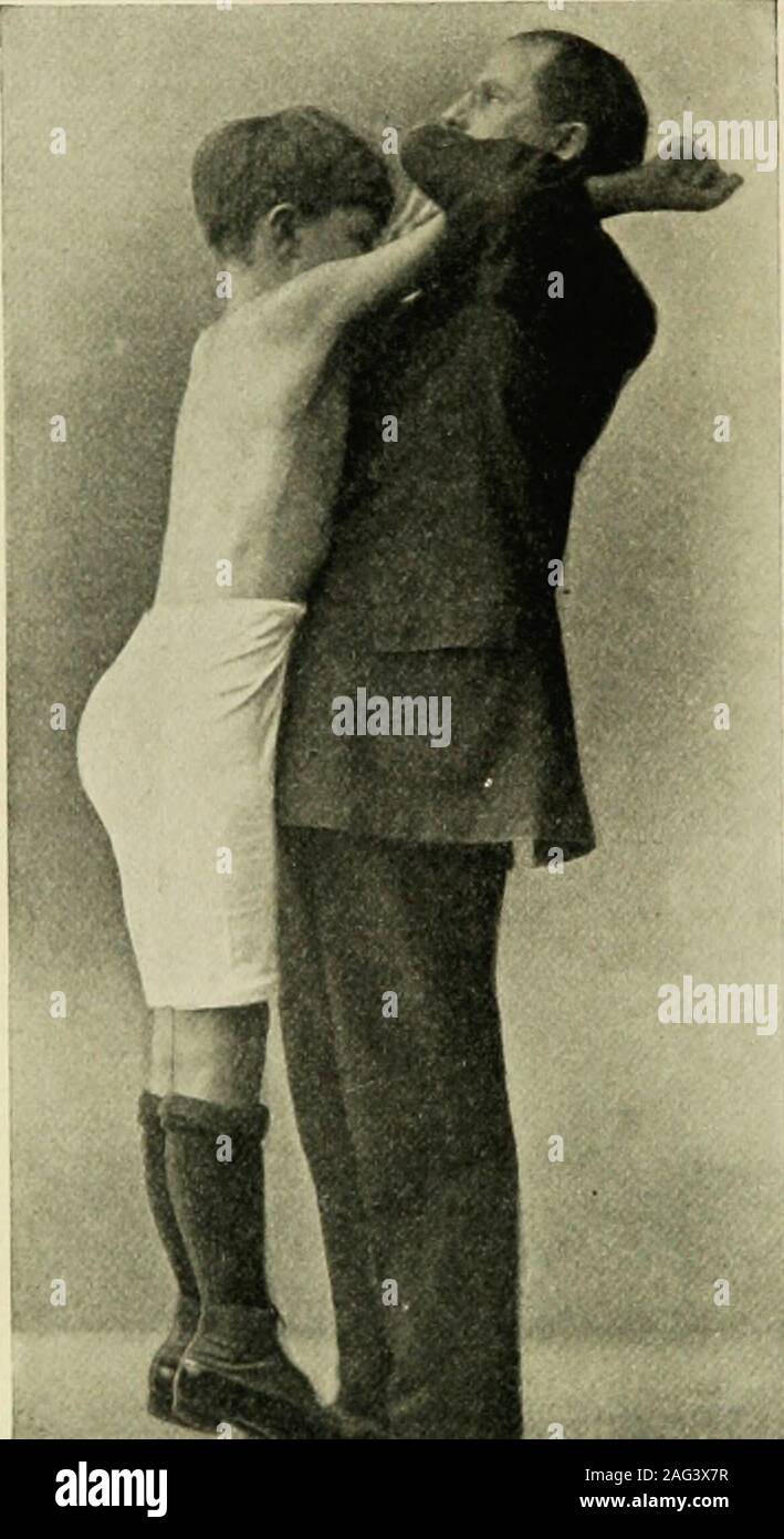 Spine deformities hi-res stock photography and images - Alamy