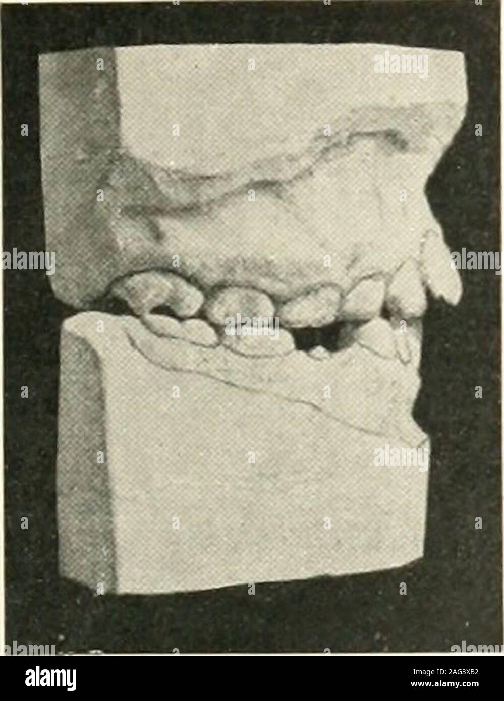 Dental deformity hi-res stock photography and images - Alamy
