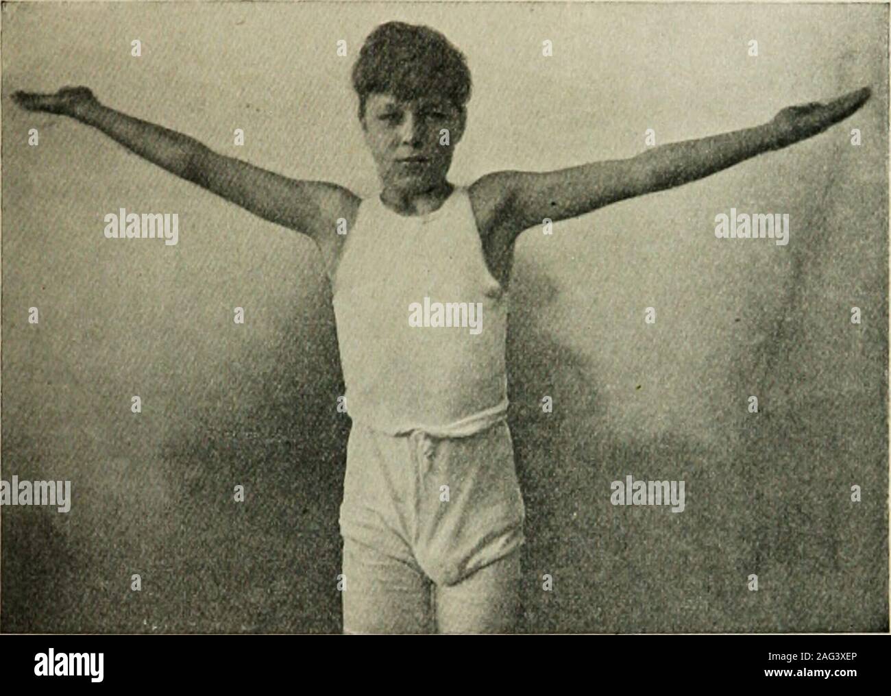 Two toes forward hi-res stock photography and images - Alamy