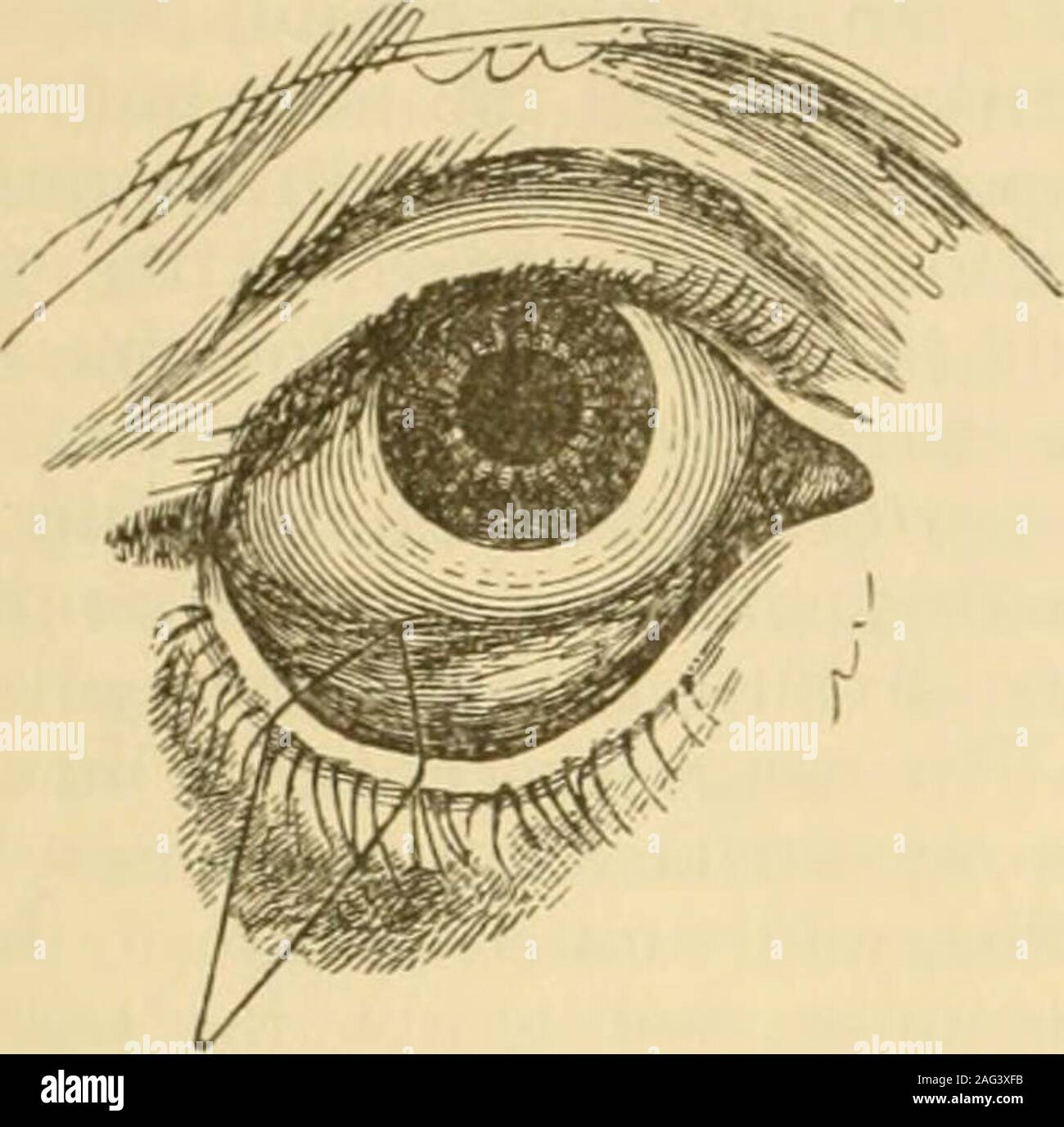 Outer canthus hi-res stock photography and images - Alamy