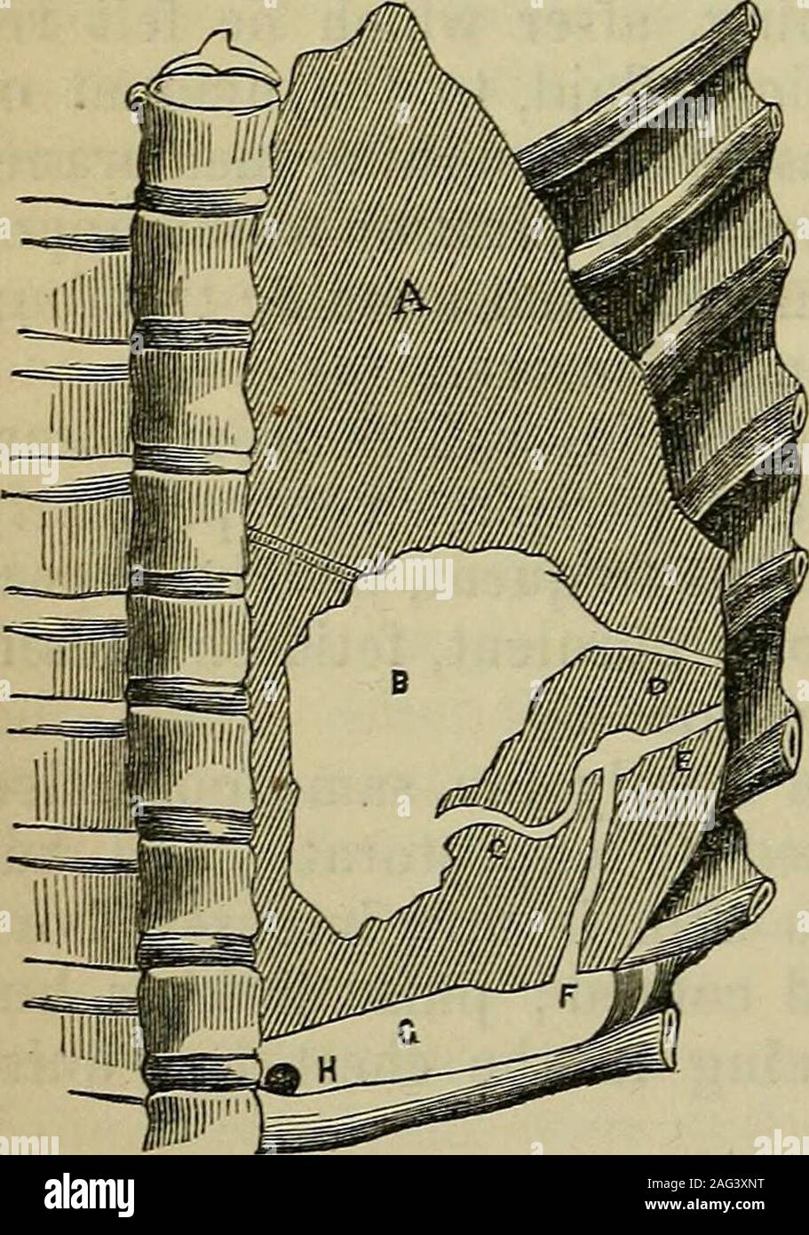 1815 surgery hi-res stock photography and images - Alamy