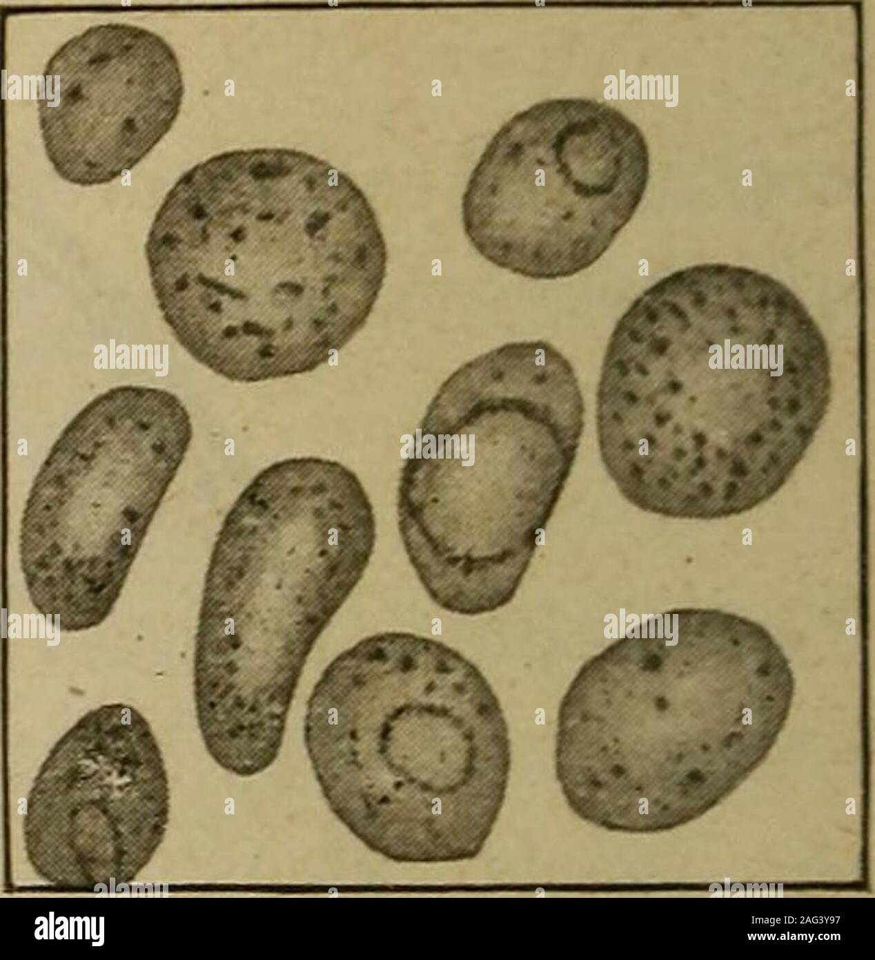 Bothriocephalus hi-res stock photography and images - Alamy