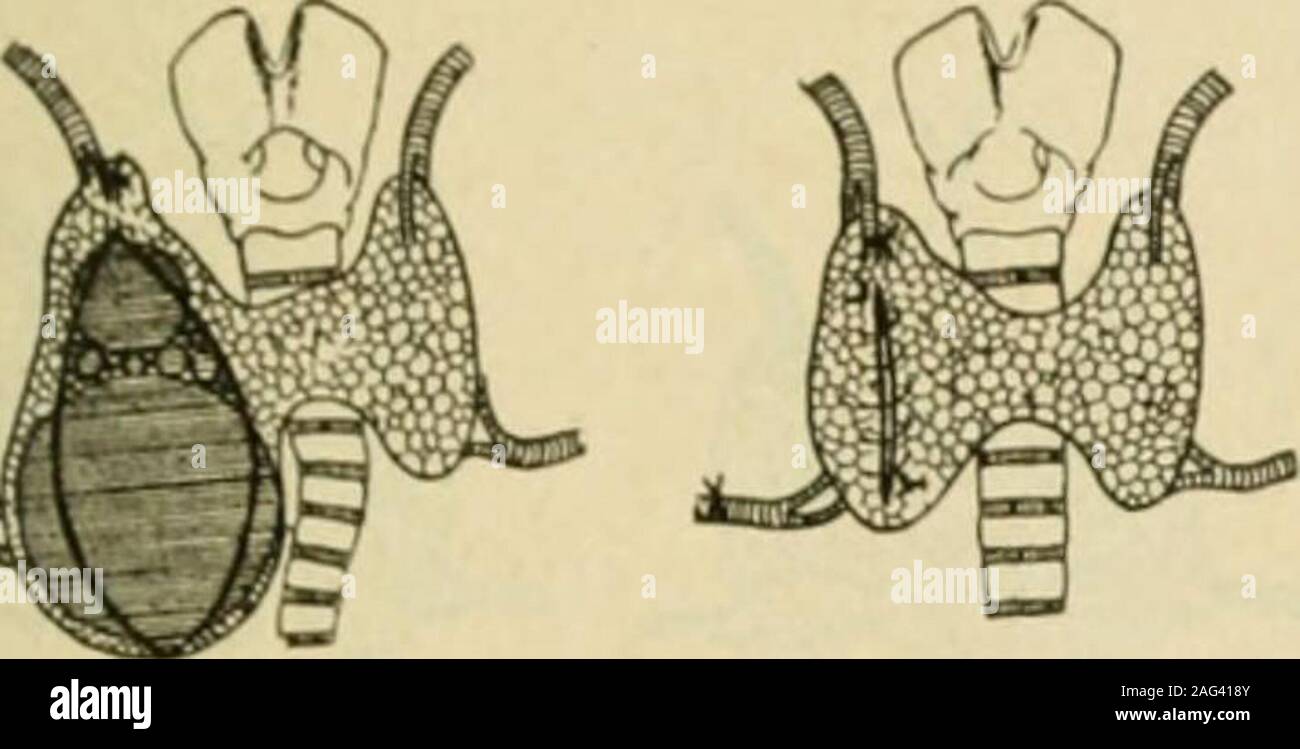 6th cervical vertebra hi-res stock photography and images - Alamy