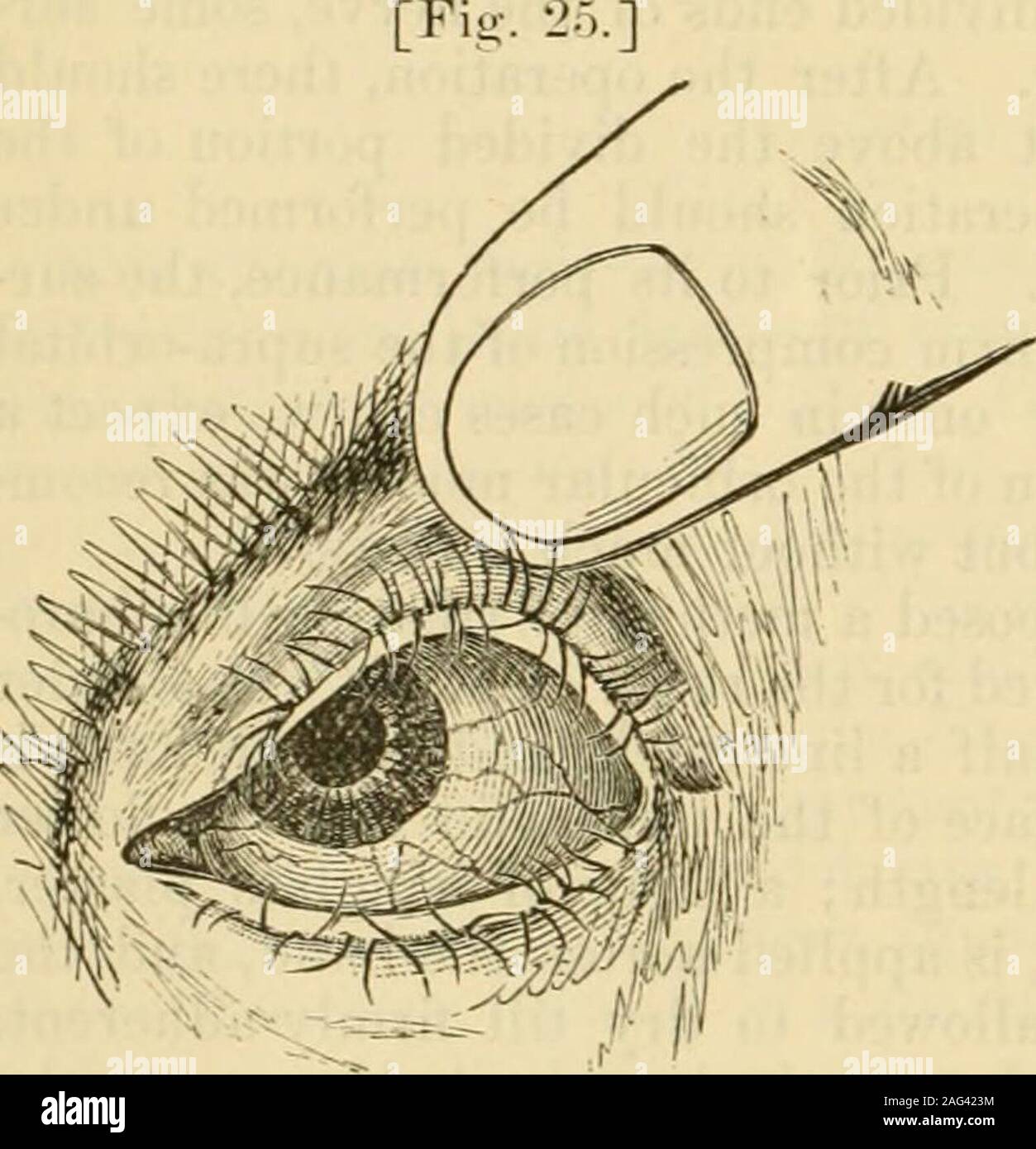 Distichiasis hi-res stock photography and images - Alamy
