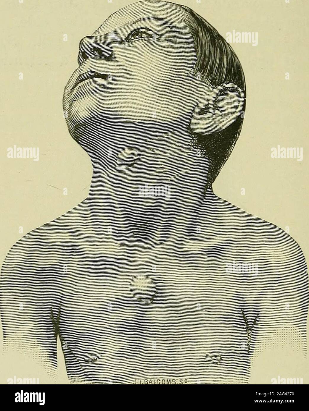 Lamb glands hi-res stock photography and images - Alamy