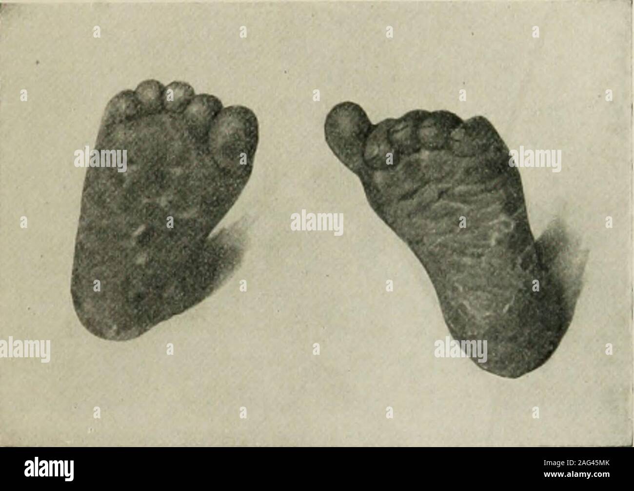 . The practice of pediatrics. ssy, shining SYPHILIS 661 appearance. How ...