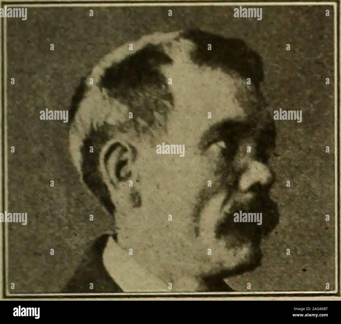 Napoleon syndrome hi-res stock photography and images - Alamy