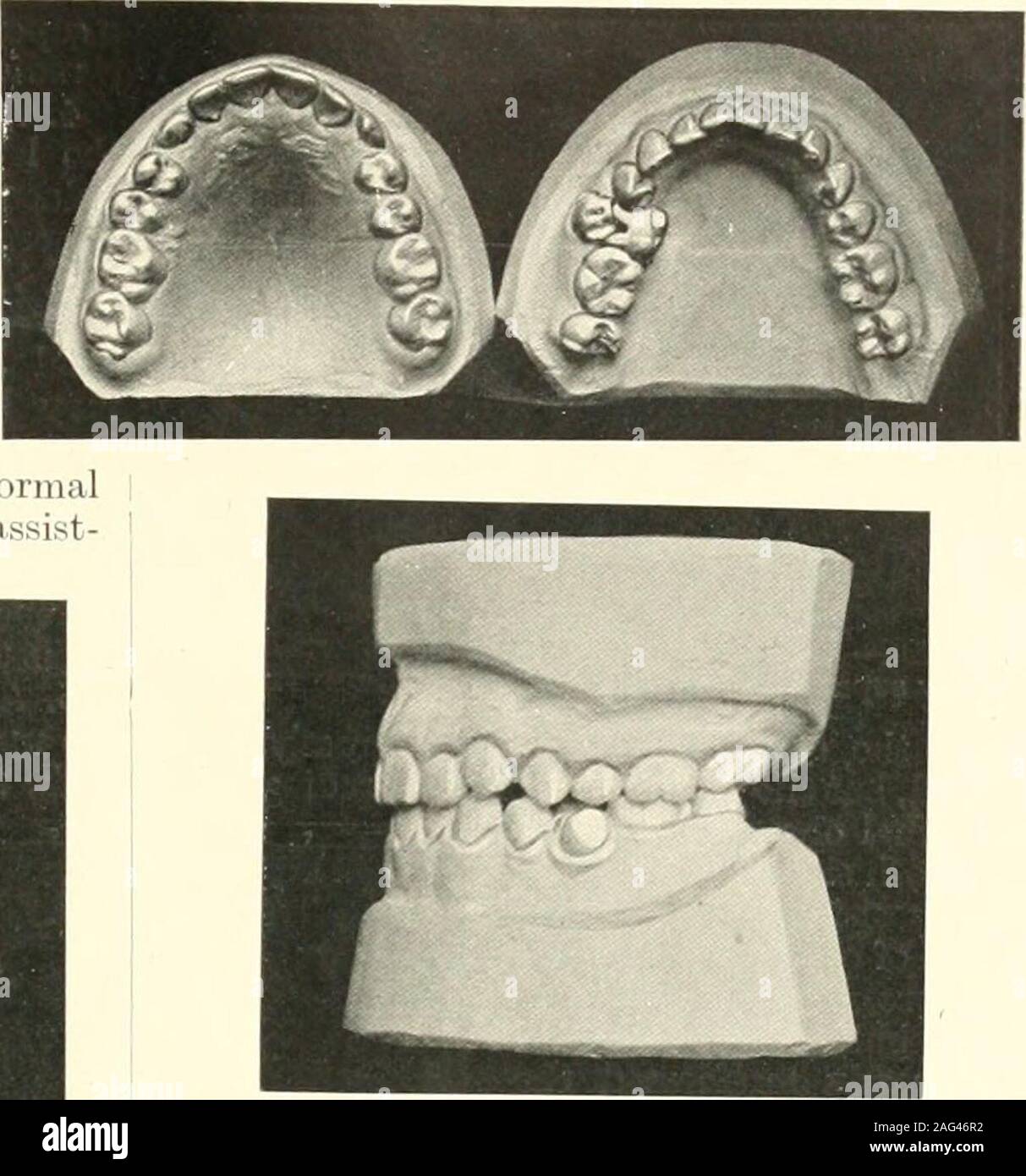 . The science and practice of dental surgery. Fig. 121).—Retained ...