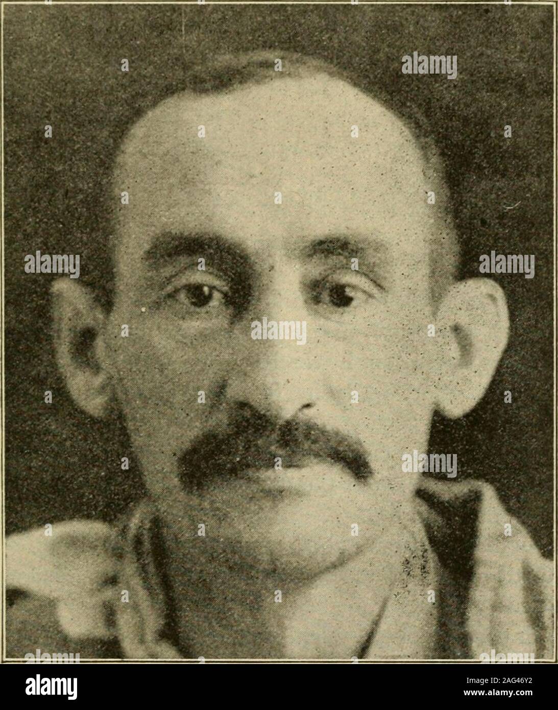 Skin graft nose hi-res stock photography and images - Alamy