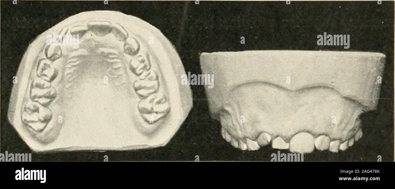 Inferior labial hi-res stock photography and images - Alamy