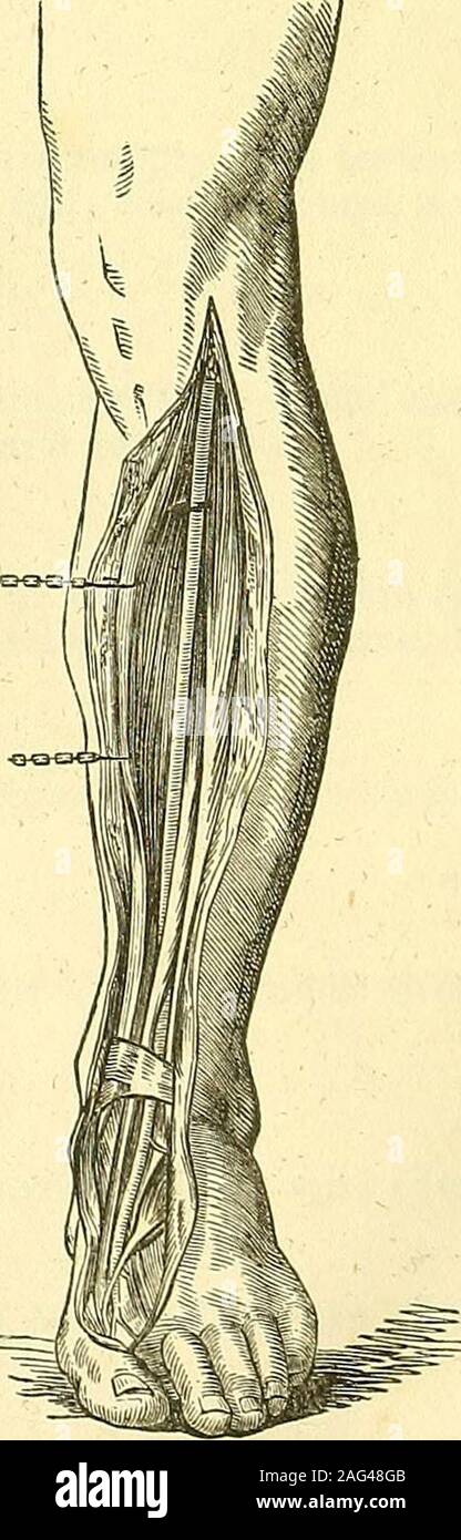 Anterior tibial muscles hi-res stock photography and images - Alamy