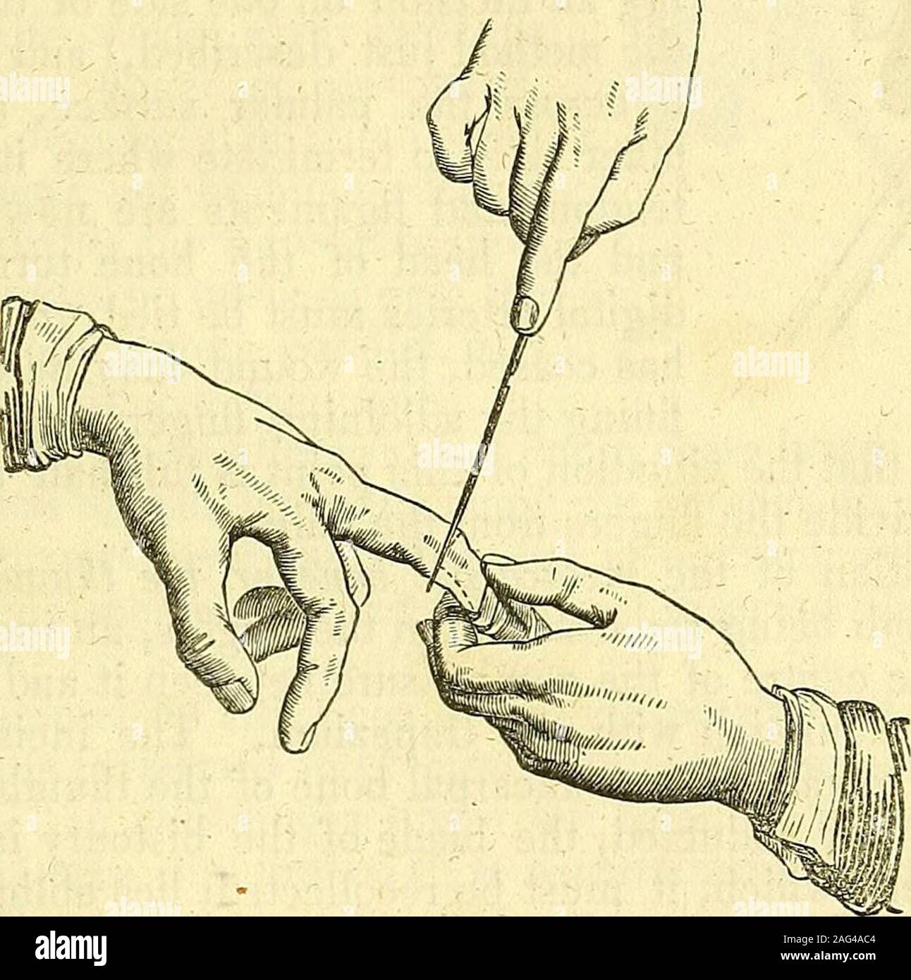 . The principles and practice of modern surgery. -ing down as far ^as ...