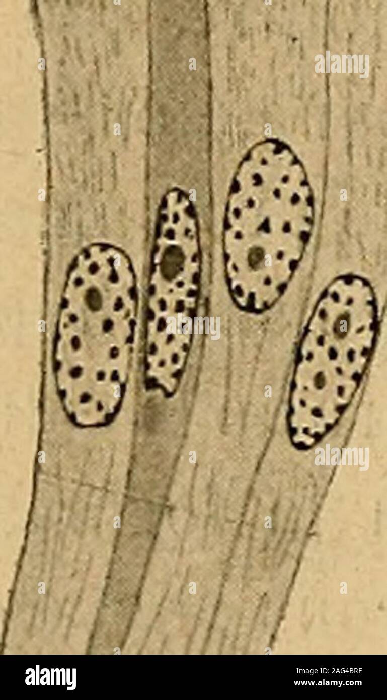 Mucoide hi-res stock photography and images - Alamy