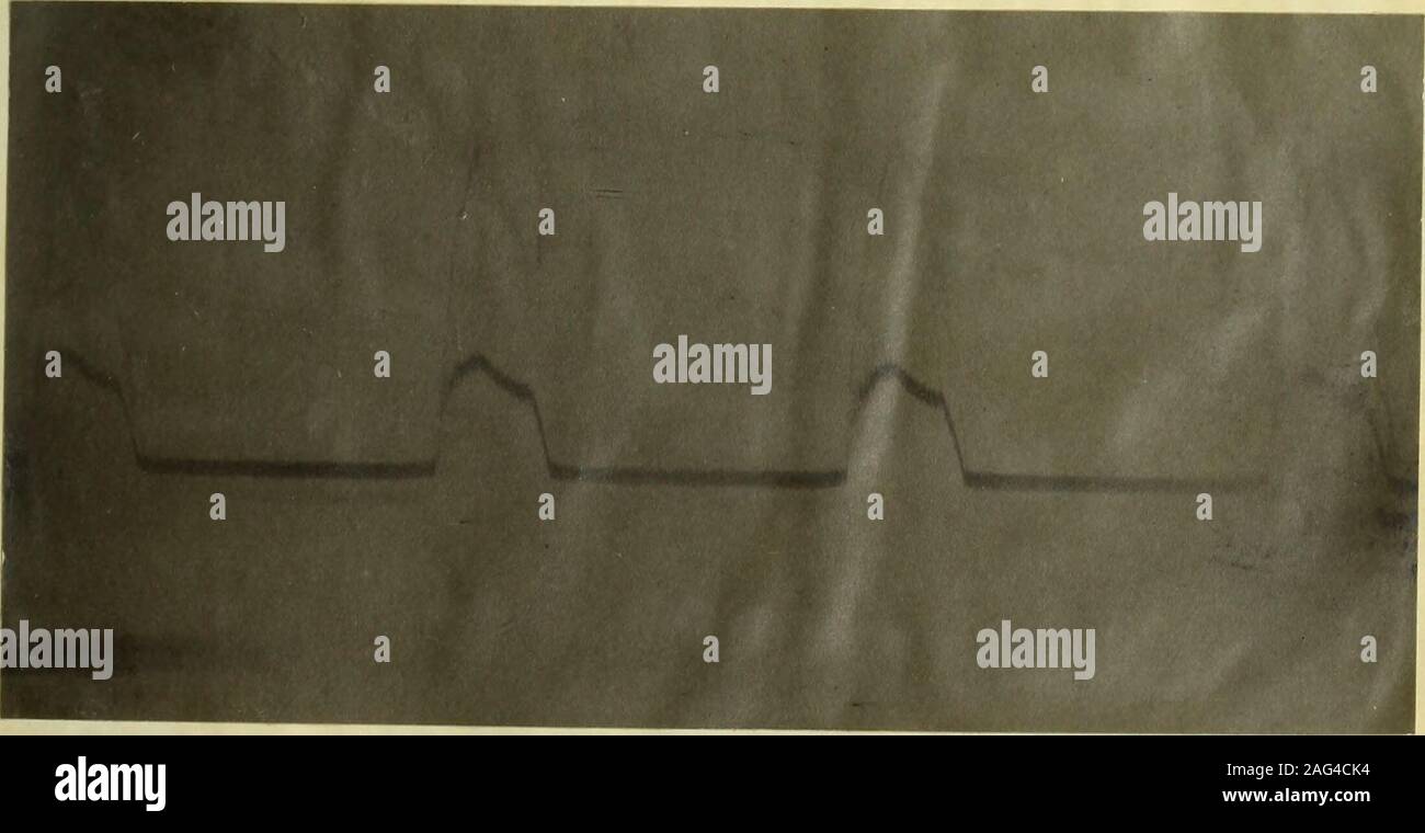 Alternating loop hi-res stock photography and images - Alamy