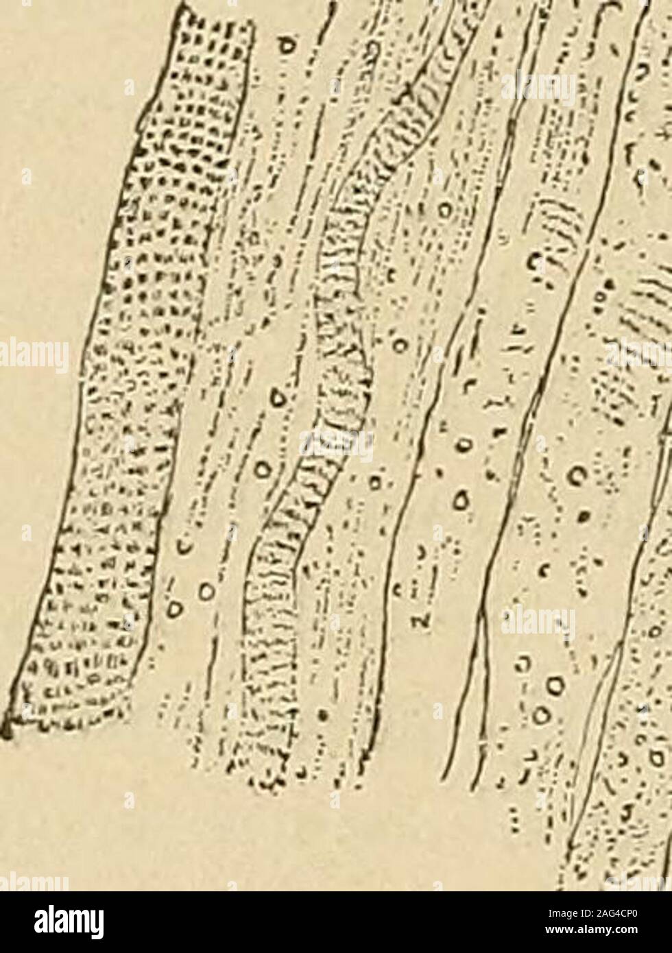 Normal appearance of spinal cord hi-res stock photography and images ...