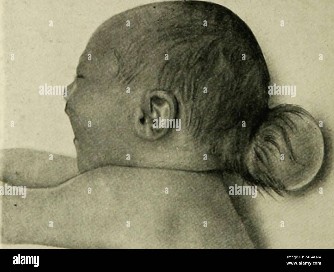 . The practice of pediatrics. ypes of cerebral malformation are of ...