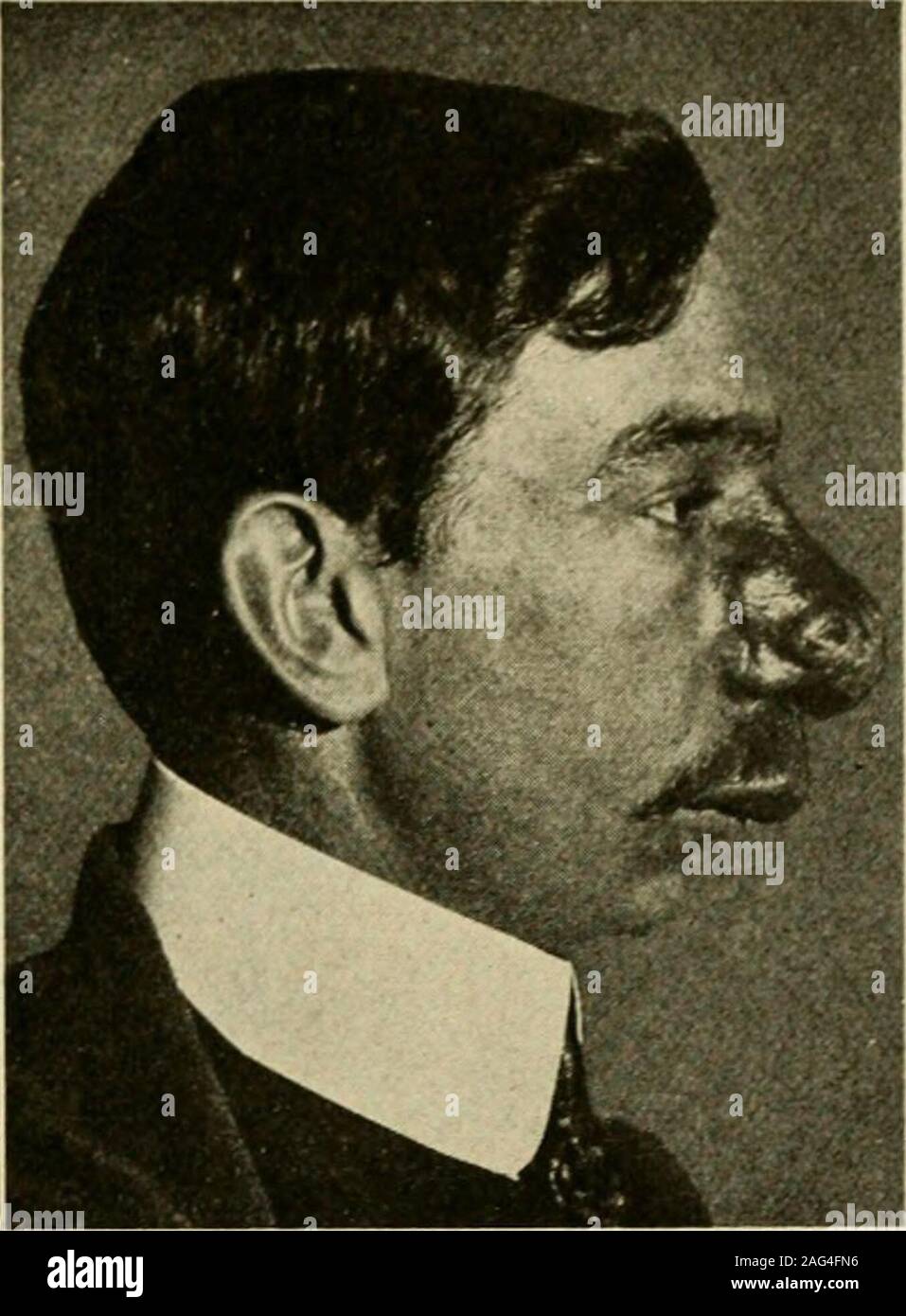 Submaxillary glands hi-res stock photography and images - Alamy