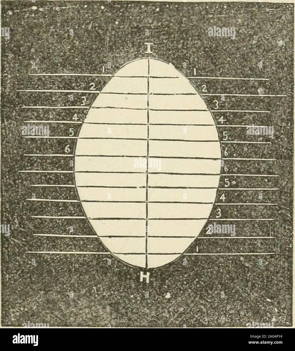 Pitch circle diameter hi-res stock photography and images - Alamy
