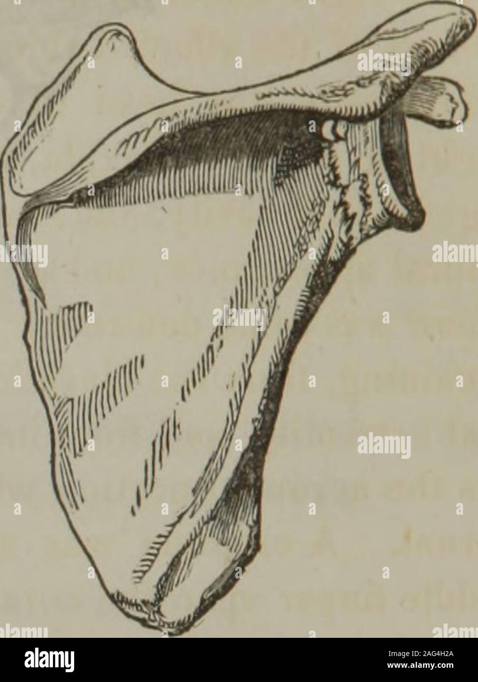 Bone fractures chest hi-res stock photography and images - Alamy