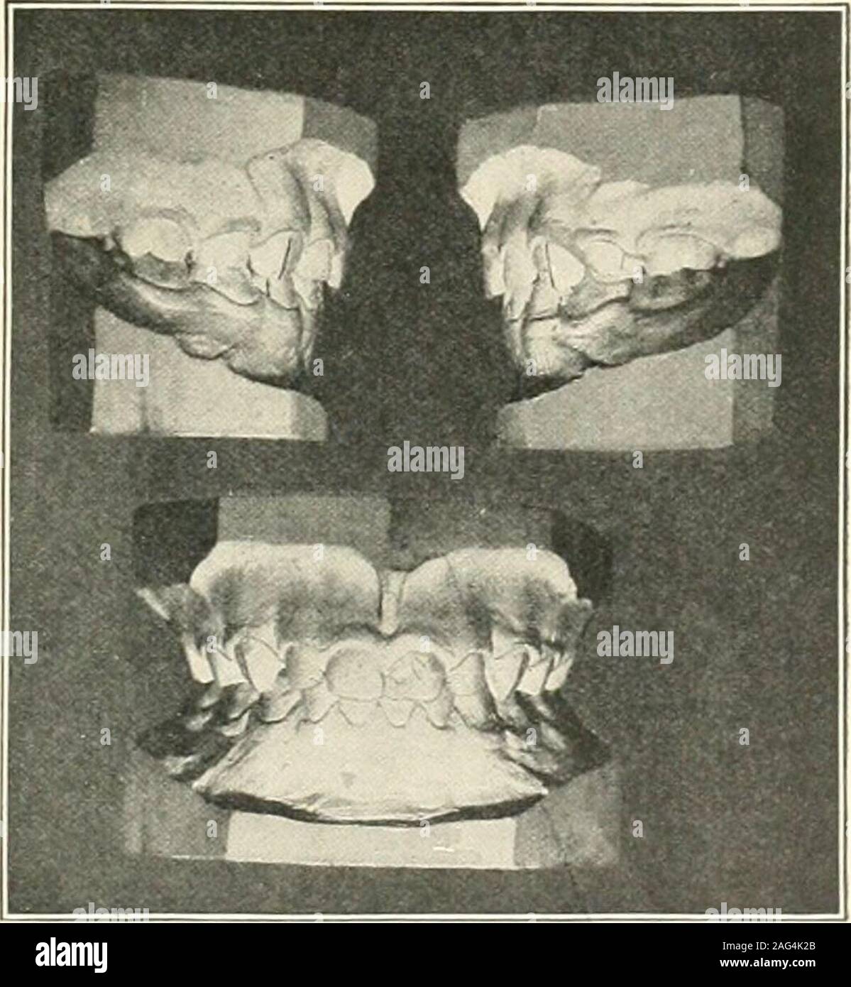 . The science and practice of dental surgery. e median suture of the ...
