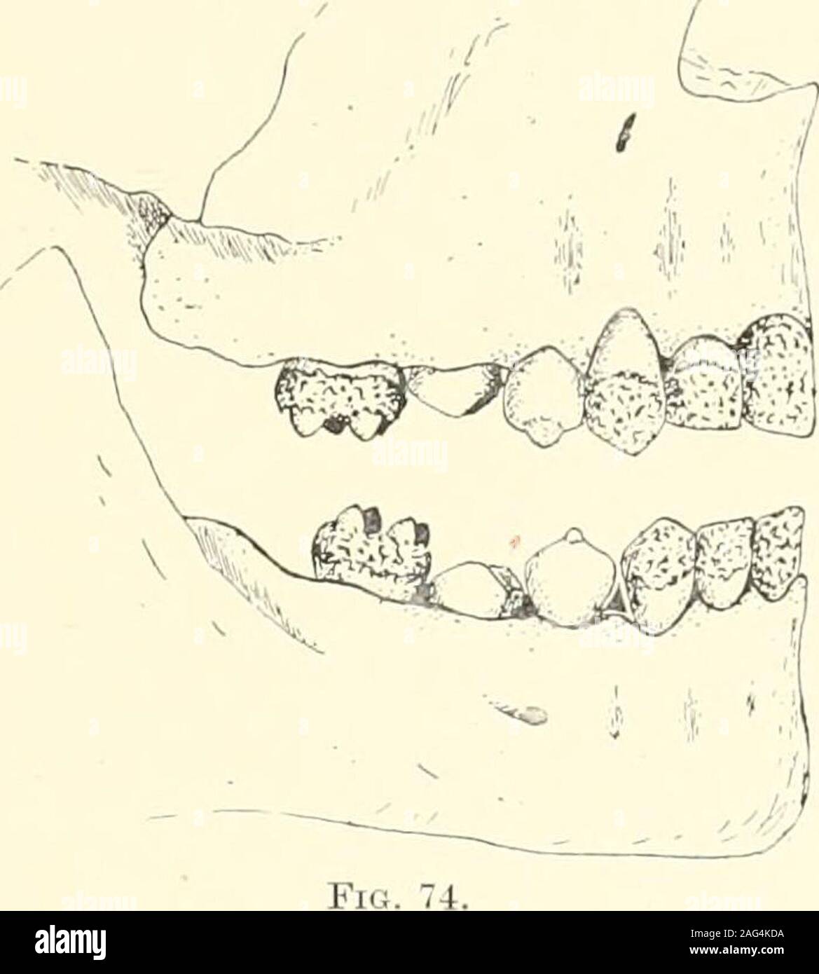 . The science and practice of dental surgery. Fig. third molars, in ...