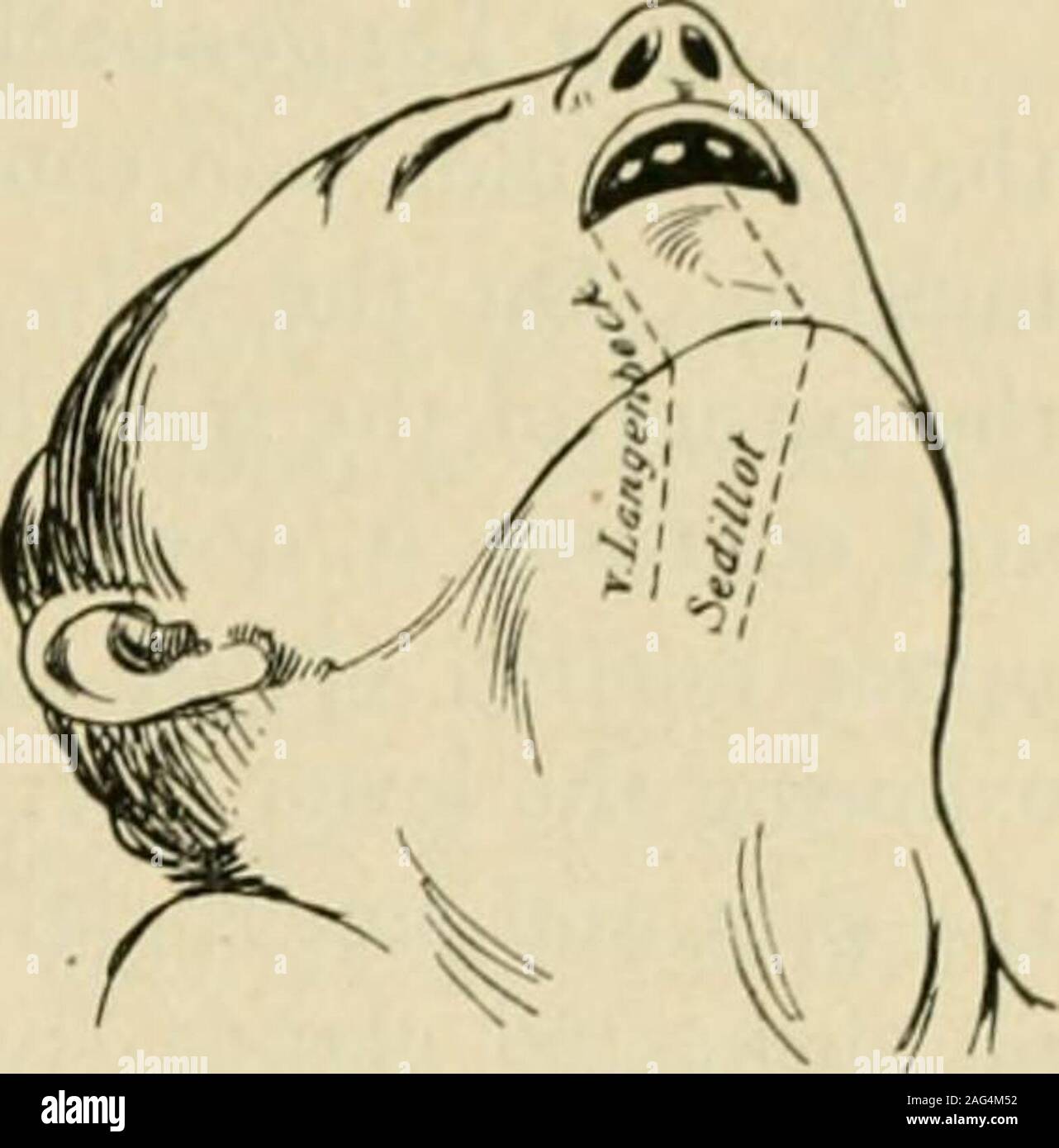 . Manual of operative surgery. sedillots operation 163 edition ...