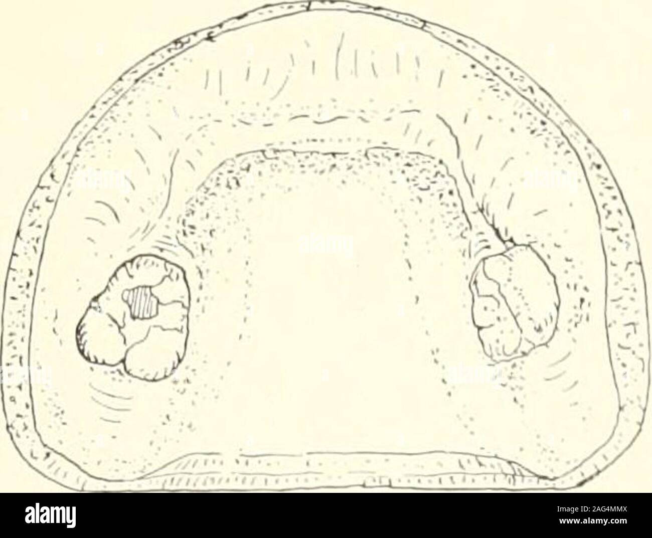 Peg shape incisor teeth hi-res stock photography and images - Alamy