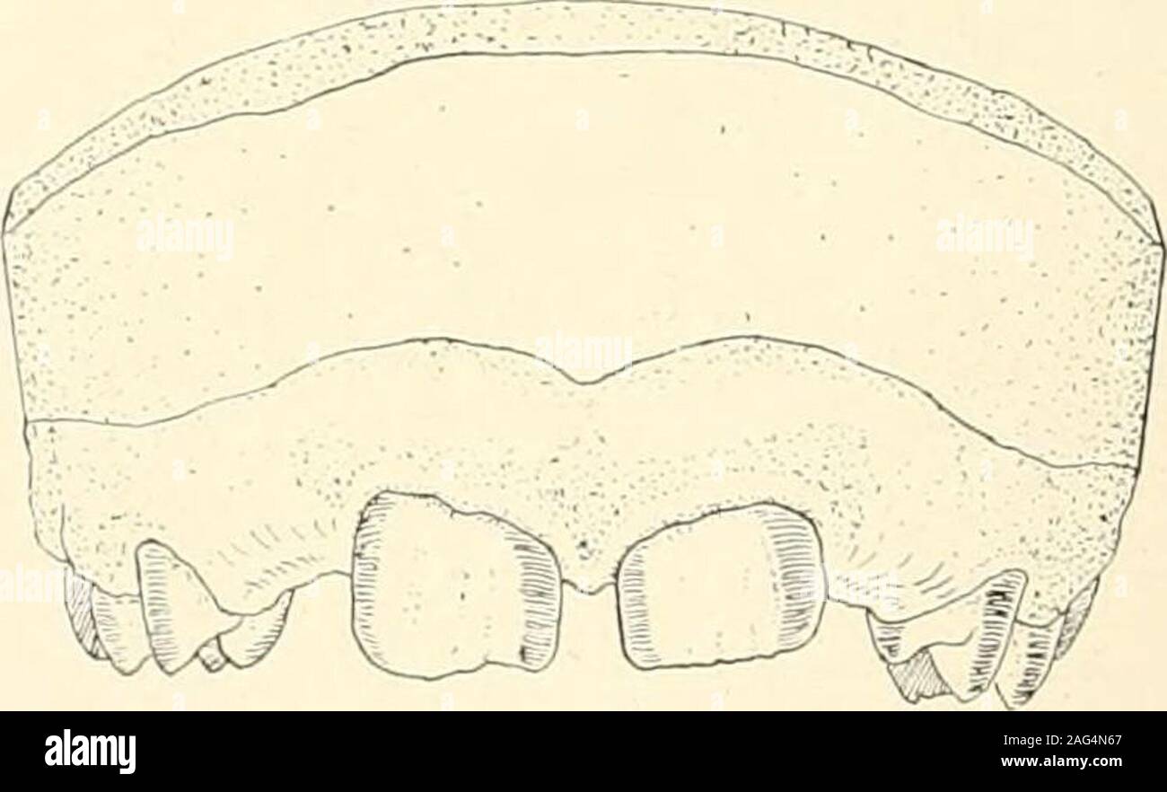 49 whole teeth hi-res stock photography and images - Alamy