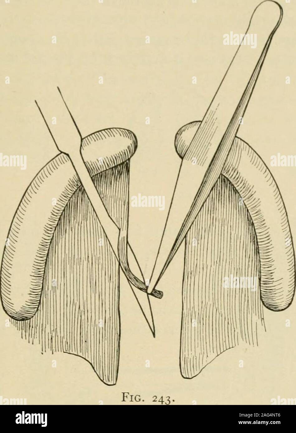 Cleft tongue hi-res stock photography and images - Alamy