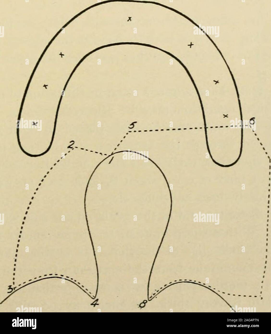 . Manual of operative surgery. Fig. 240.—{Lane . Fig. 241.—{Lane.) 154 ...