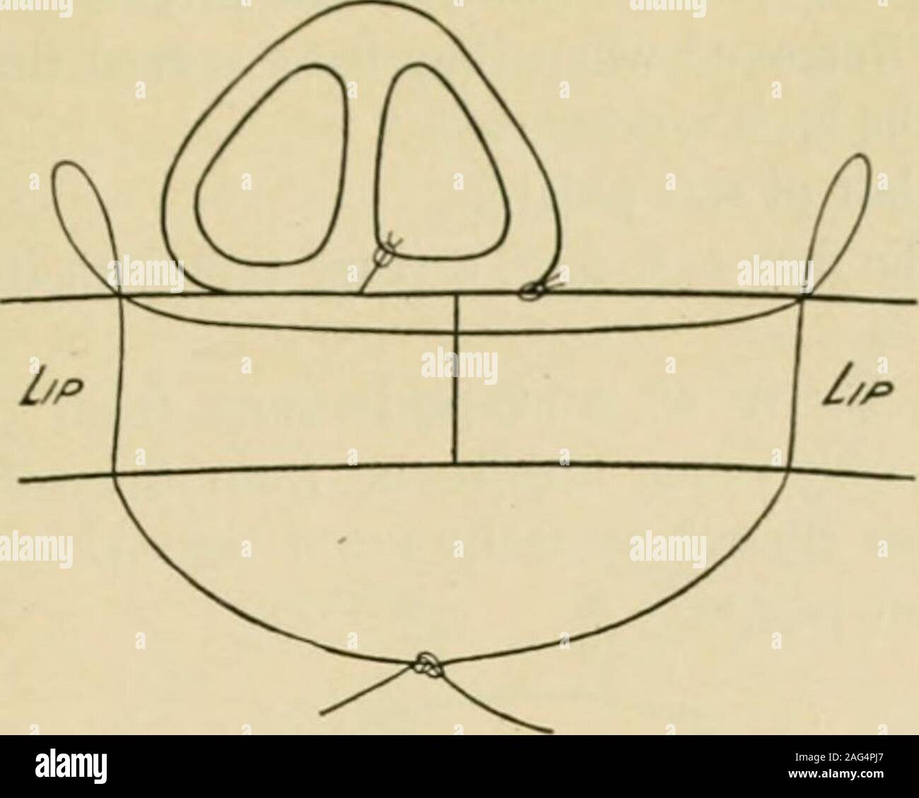 Cheek flap hi-res stock photography and images - Alamy