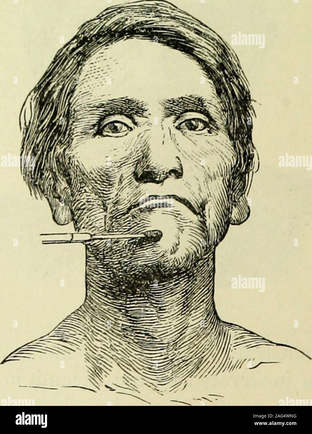 . Medical electricity; a practical treatise on the applications of ...