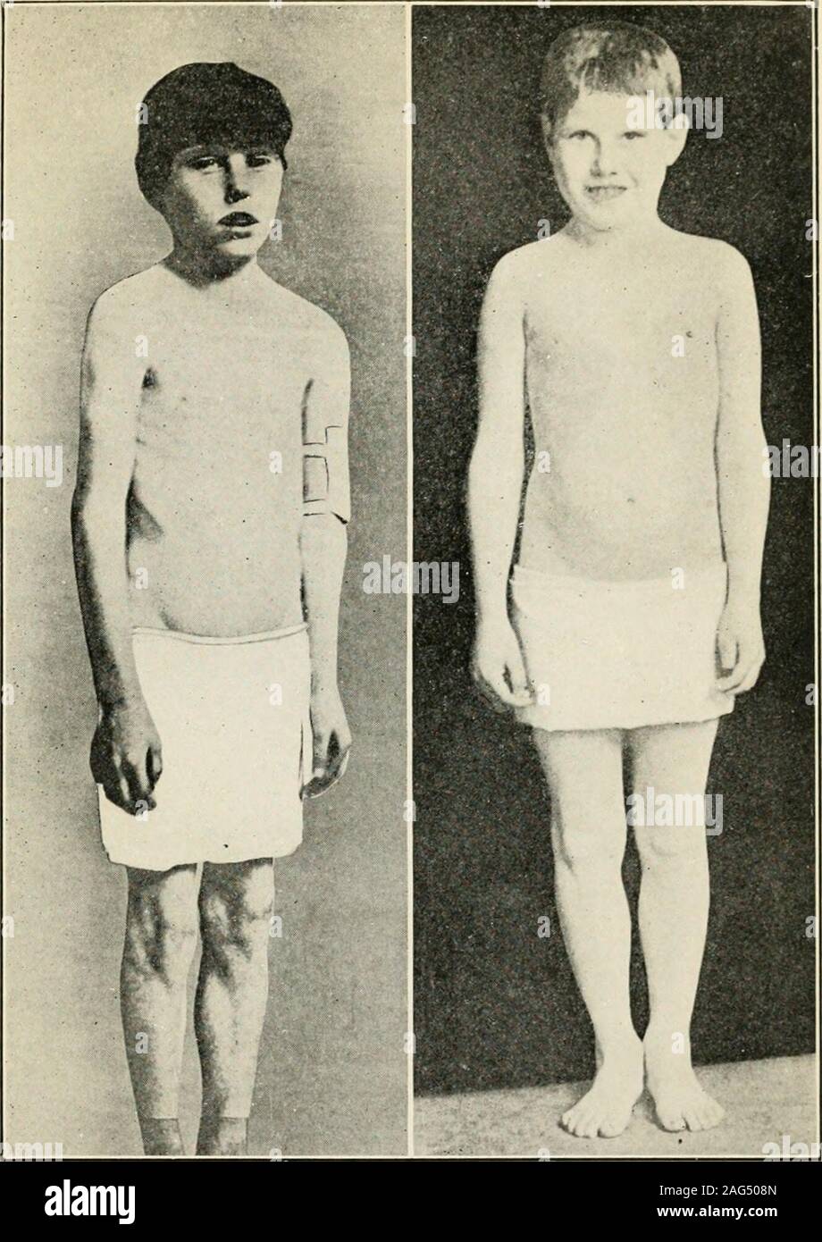 Physicaldevelopment hi-res stock photography and images - Alamy